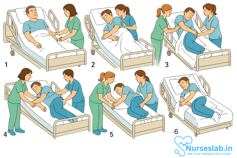 Turning a Patient to Lateral Position - Nurseslab
