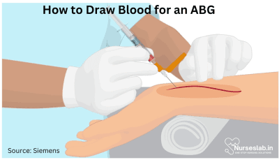 ABG Interpretation for Nurses - Nurseslab