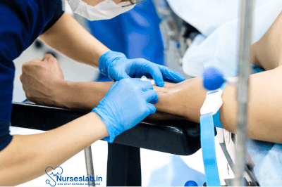 How to manage Difficult Cannulation - Nurseslab