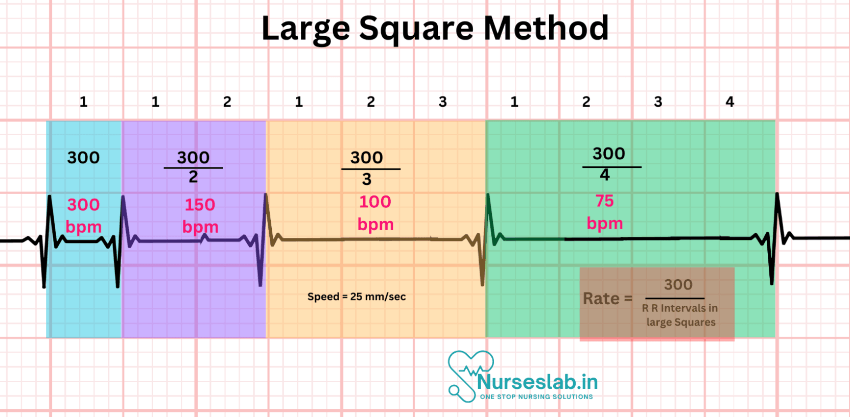 Calculating Heart Rate on an ECG: Explained - Nurseslab.in