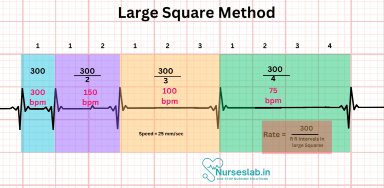 Calculating Heart Rate on an ECG: Explained - Nurseslab