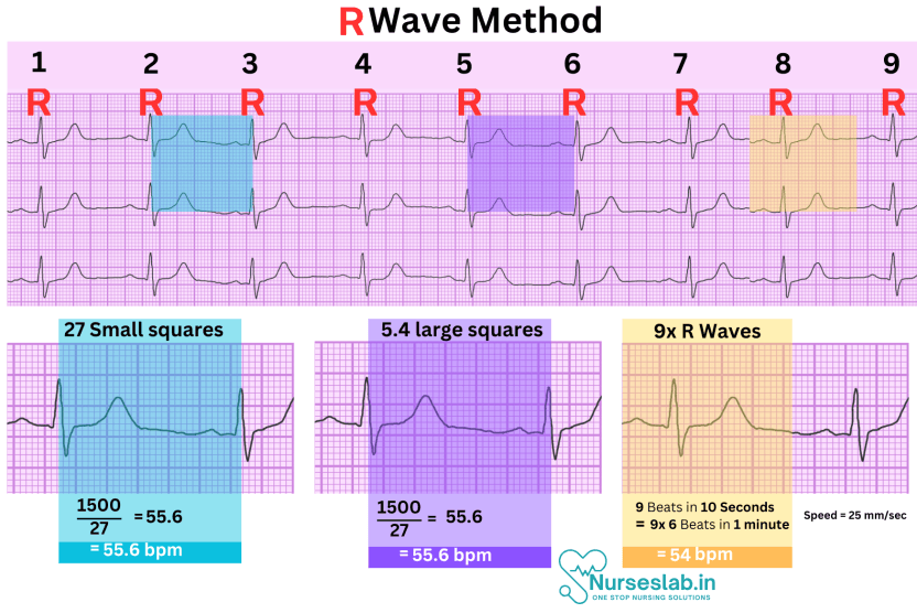 Calculating Heart Rate on an ECG: Explained - Nurseslab