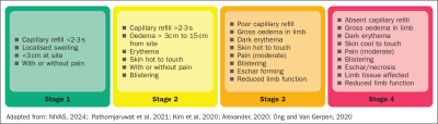 IV Therapy: Infiltration vs Extravasation with Case Studies - Nurseslab