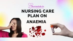 Nursing Care Plan on Anemia - Nurseslab