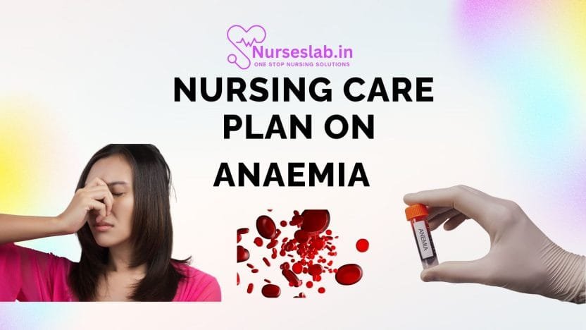 Nursing Care Plan on Anemia - Nurseslab