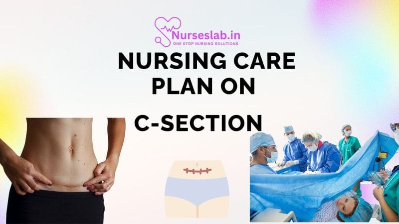 Nursing Care Plan on C-Section - Nurseslab