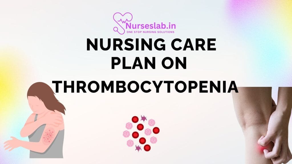 Nursing Care Plan on Deep Vein Thrombosis - Nurseslab