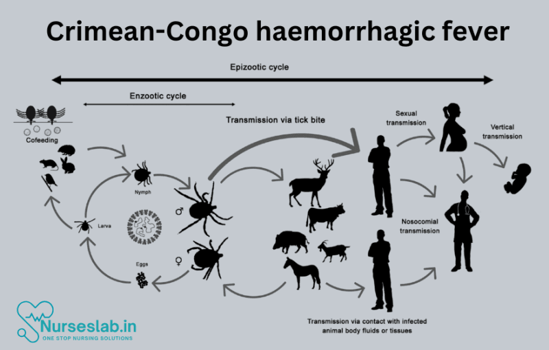Crimean-Congo Haemorrhagic Fever: A Comprehensive Overview - Nurseslab