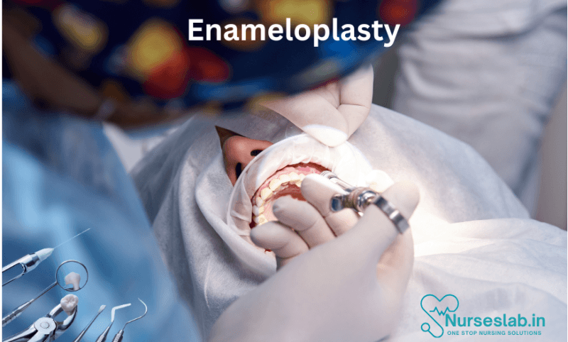 Enameloplasty procedure - Nurseslab
