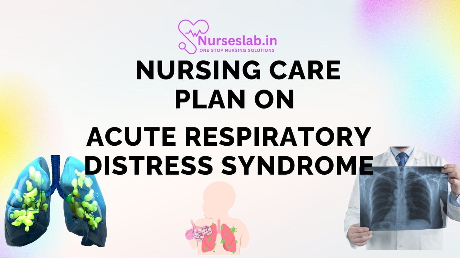 Nursing Care Plan on Acute respiratory distress syndrome (ARDS) - Nurseslab