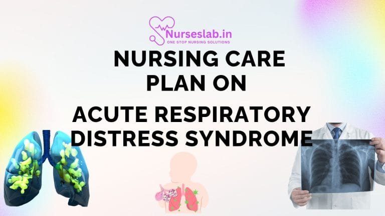 Nursing Care Plan on Acute respiratory distress syndrome (ARDS) - Nurseslab