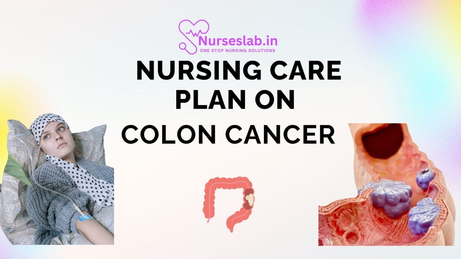 Nursing Care Plan on Colostomy and Ileostomy - Nurseslab