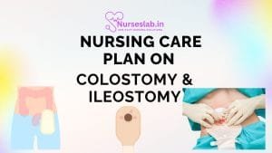 Nursing Care Plan on Colostomy and Ileostomy - Nurseslab