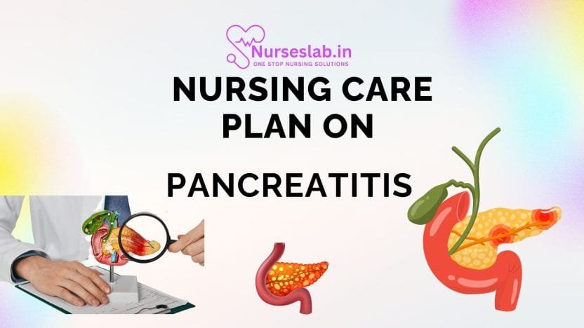 Nursing Care Plan on Pancreatitis - Nurseslab