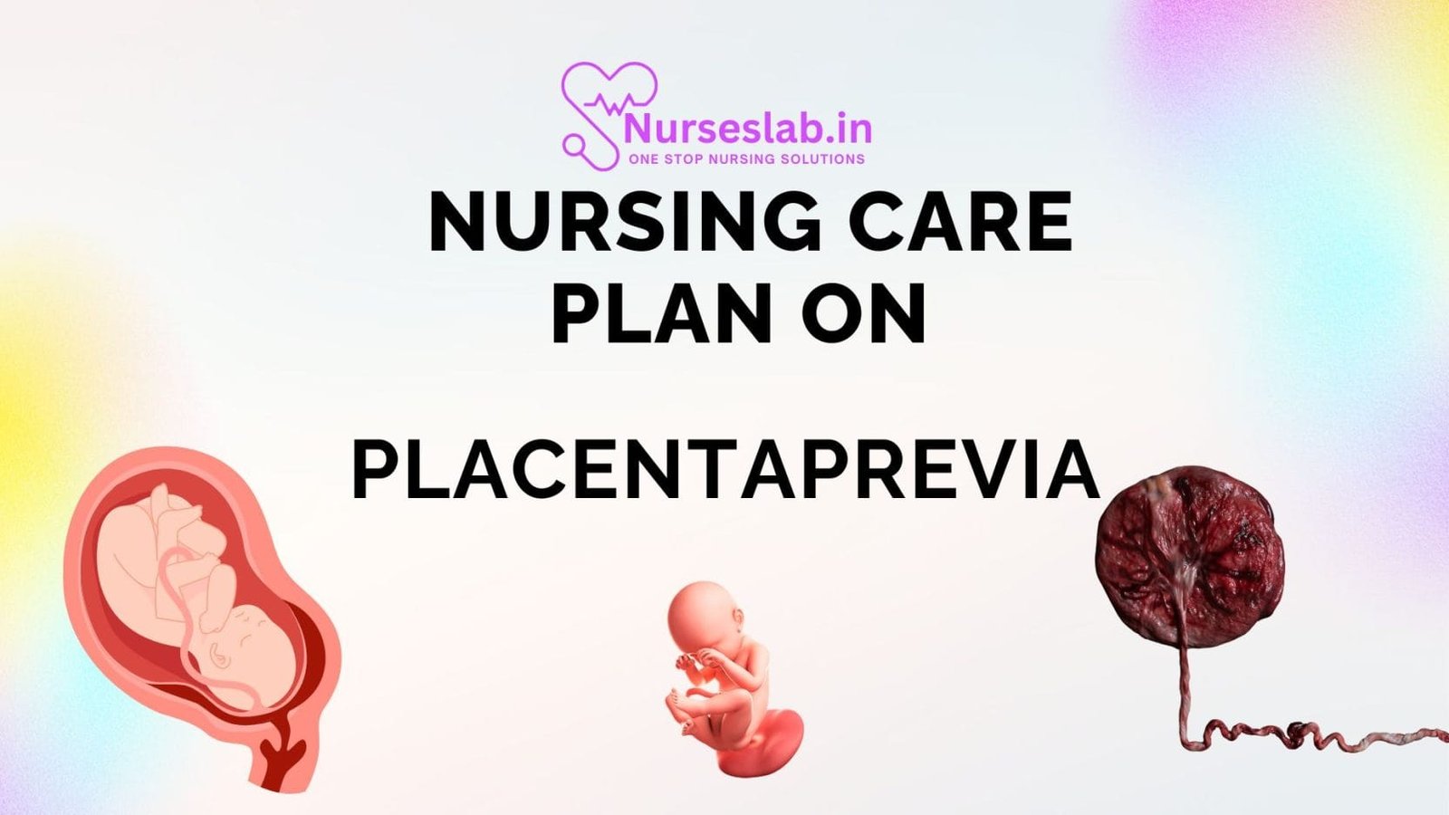 Nursing Care Plan on Placenta Previa - Nurseslab