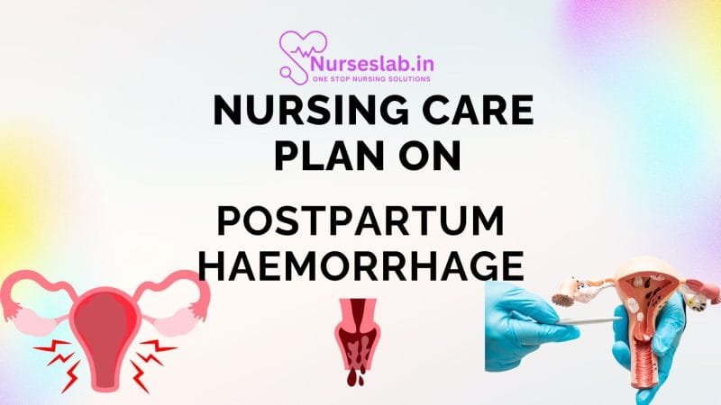 Nursing Care Plan on Postpartum Haemorrhage (PPH) - Nurseslab