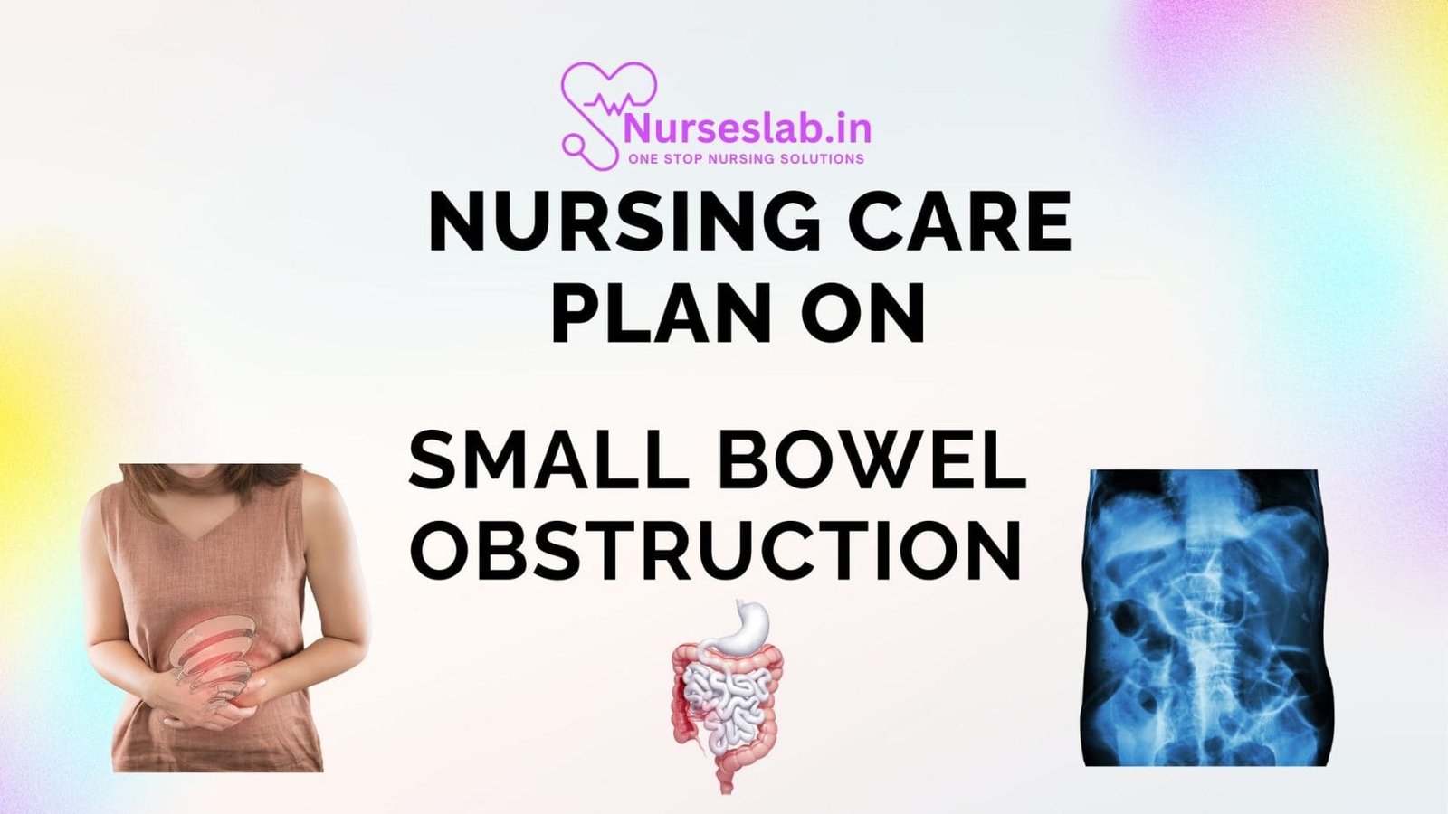 Nursing Care Plan on Ulcerative Colitis - Nurseslab