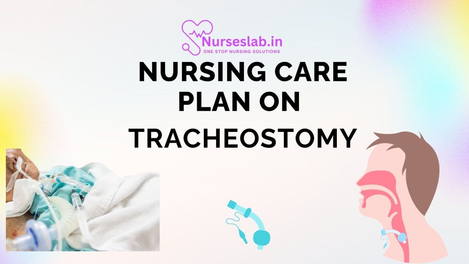 Nursing Care Plan on Tracheostomy - Nurseslab