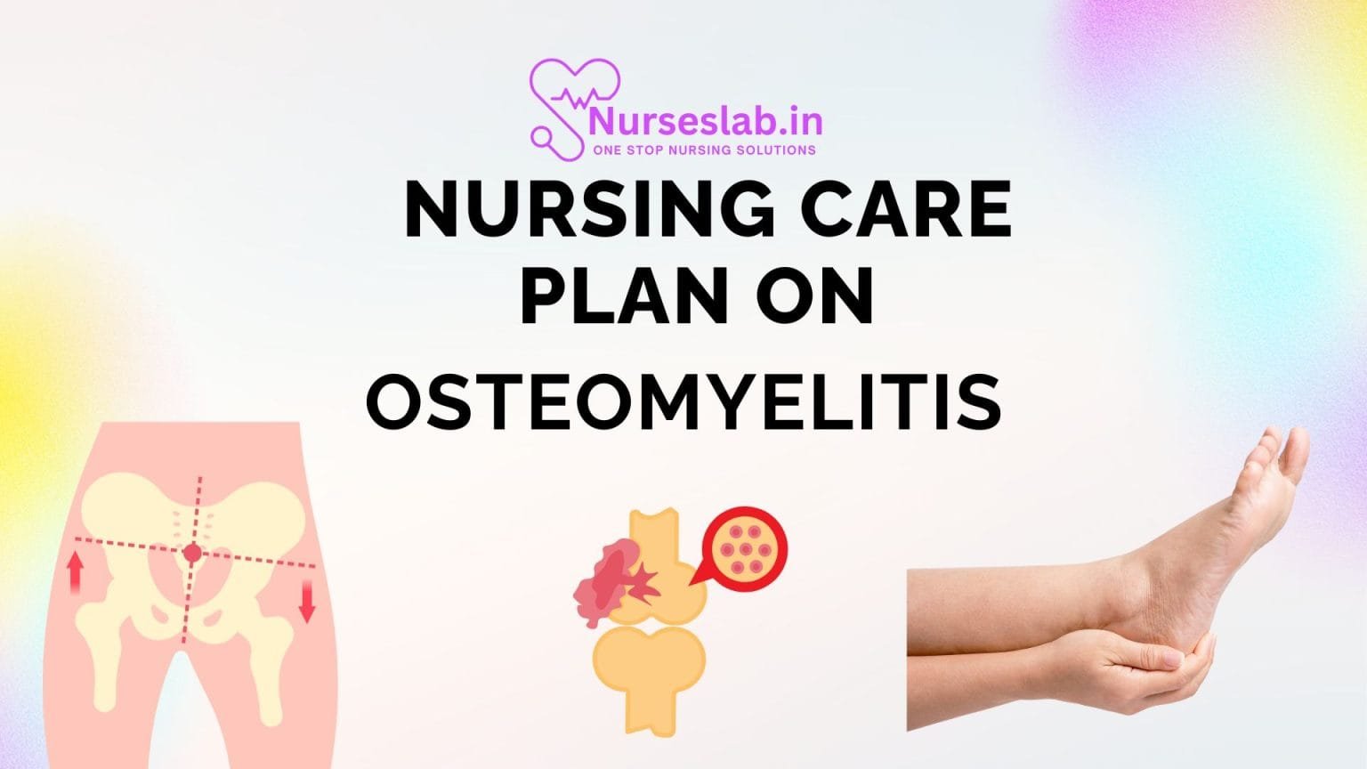 Nursing Care Plan on Osteomyelitis - Nurseslab