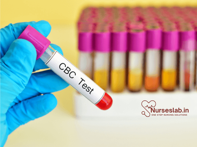 How to Calculate the Absolute Neutrophil Count - Nurseslab