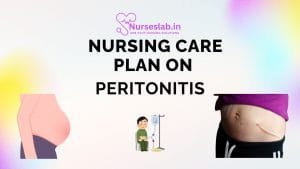 Nursing Care Plan on Small Bowel Obstruction - Nurseslab