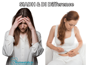 SIADH versus DI What's the Difference - Nurseslab