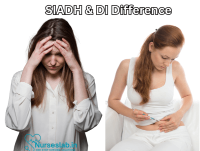 SIADH versus DI What's the Difference - Nurseslab