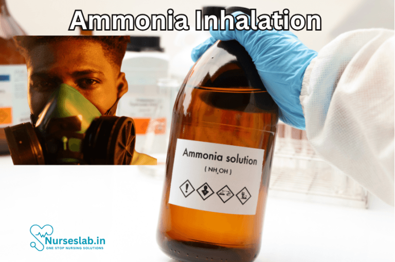 First Aid for Ammonia Inhalation - Nurseslab