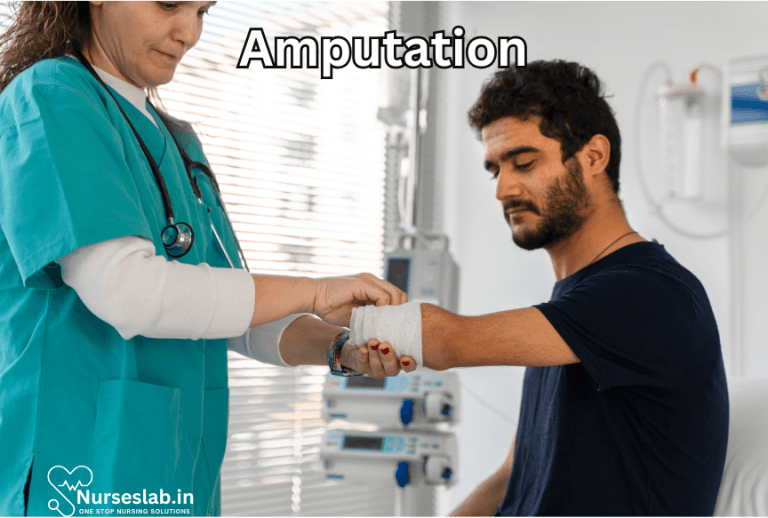 First aid for accidental amputation - Nurseslab