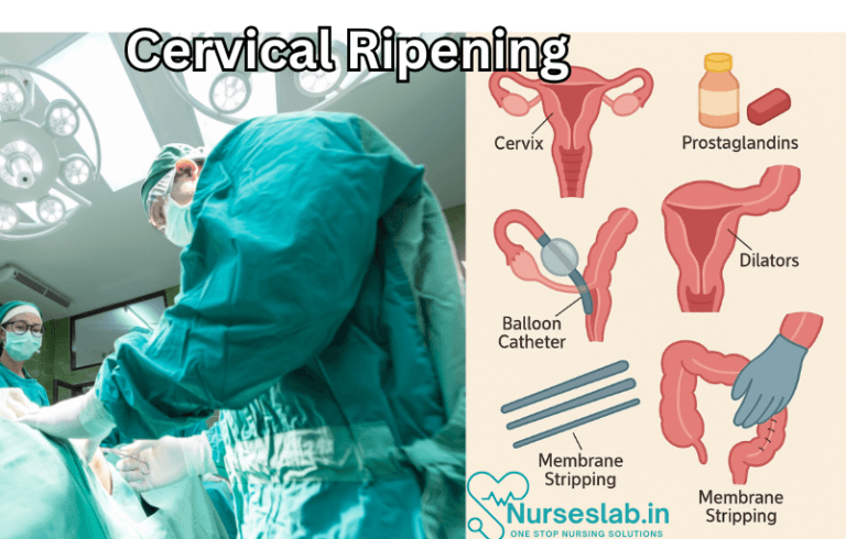 Cervical Ripening - Nurseslab
