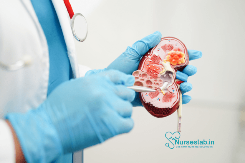 How to Calculate the Glomerular Filtration Rate - Nurseslab