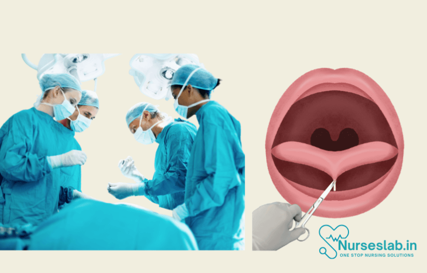 Frenotomy (Tongue-Tie Surgery in Infants) - Nurseslab