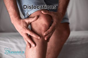 First Aid for Dislocations - Nurseslab