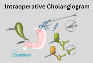 Intraoperative Cholangiogram - Nurseslab