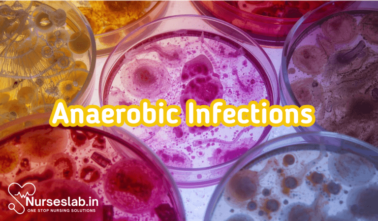 Anaerobic Infections: A Comprehensive Guide - Nurseslab