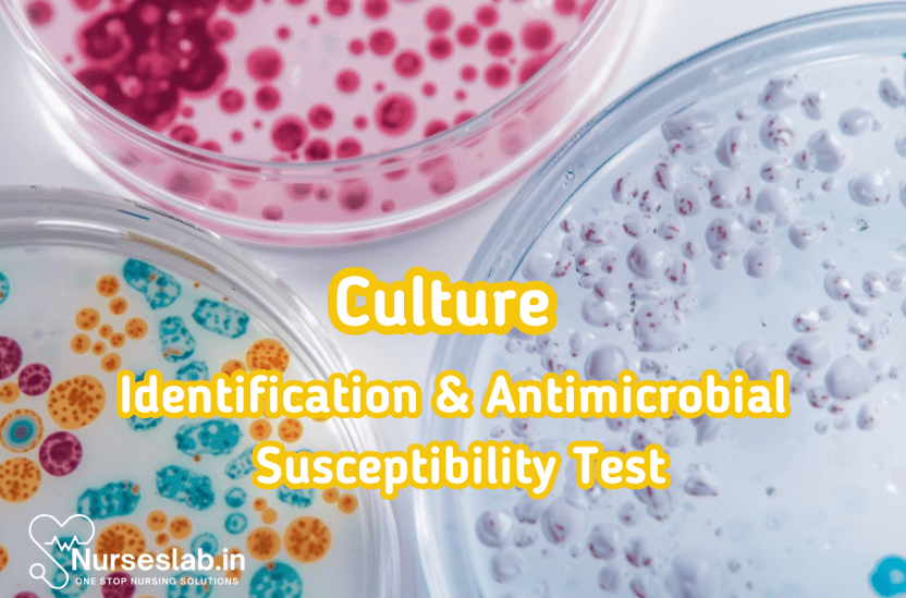 Culture: Identification and Antimicrobial Susceptibility Test - Nurseslab