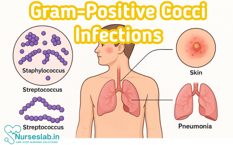 Gram-Positive Cocci Infections - Nurseslab