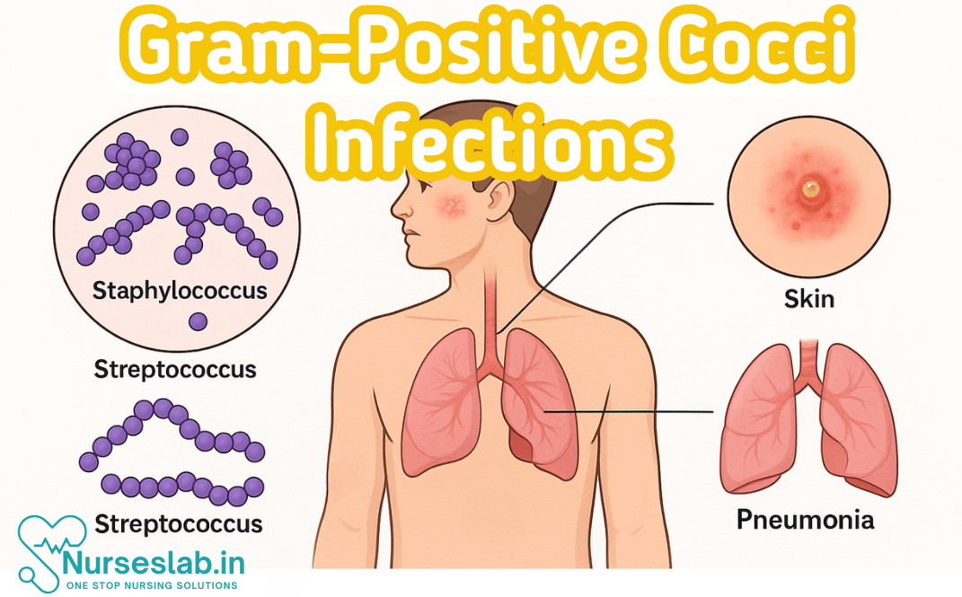 Gram-Positive Cocci Infections - Nurseslab