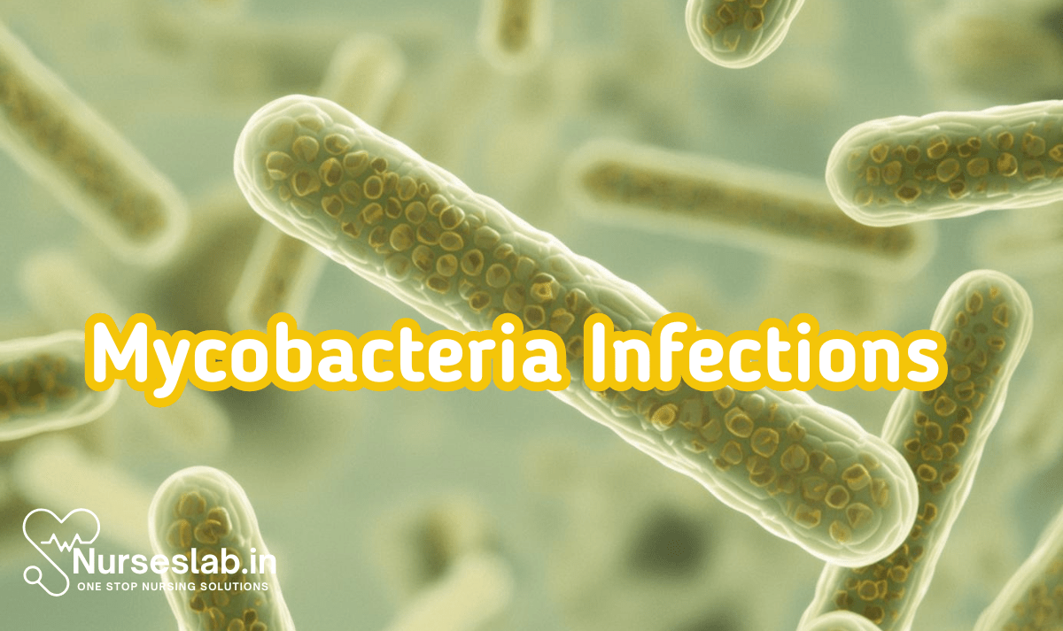 Mycobacteria Infections: A Comprehensive Guide - Nurseslab