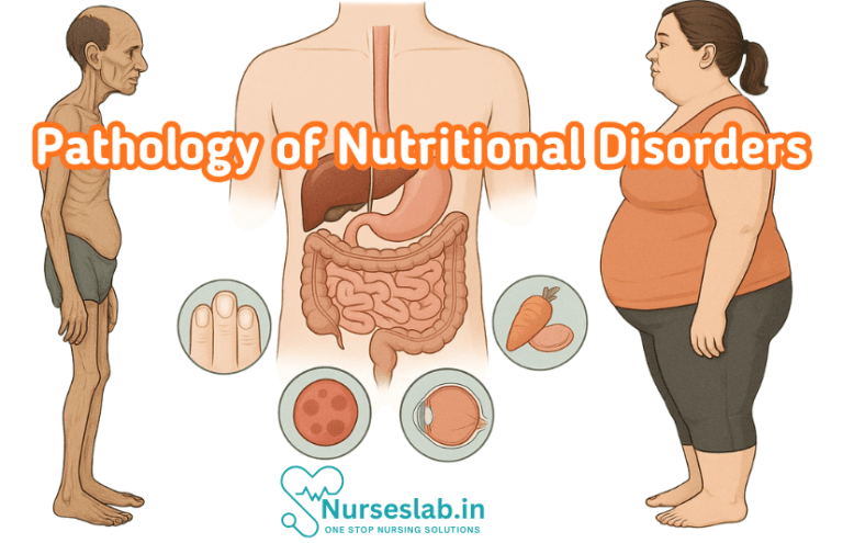 Pathology of Nutritional Disorders - Nurseslab