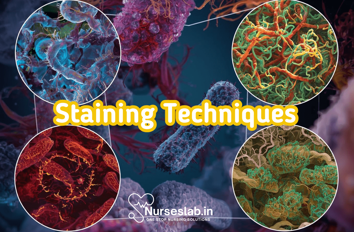 Staining Techniques: A Comprehensive Guide - Nurseslab