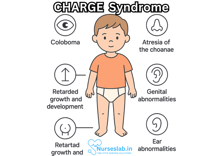 Charge Syndrome Nurseslab