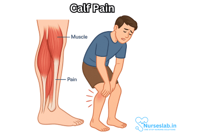 Calf Muscle Pain - Nurseslab
