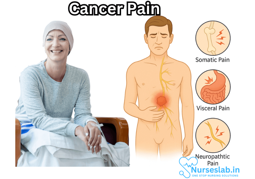 Cancer Pain - Nurseslab