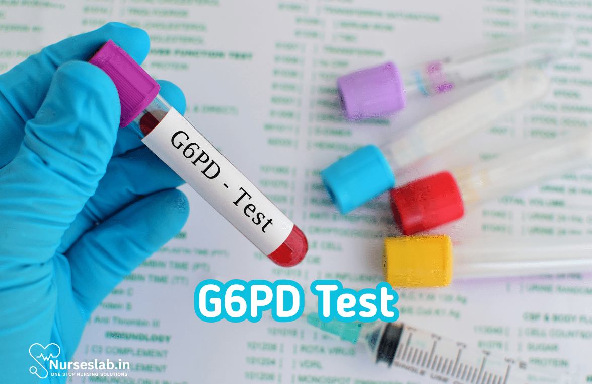 G6PD Test: Comprehensive Review - Nurseslab