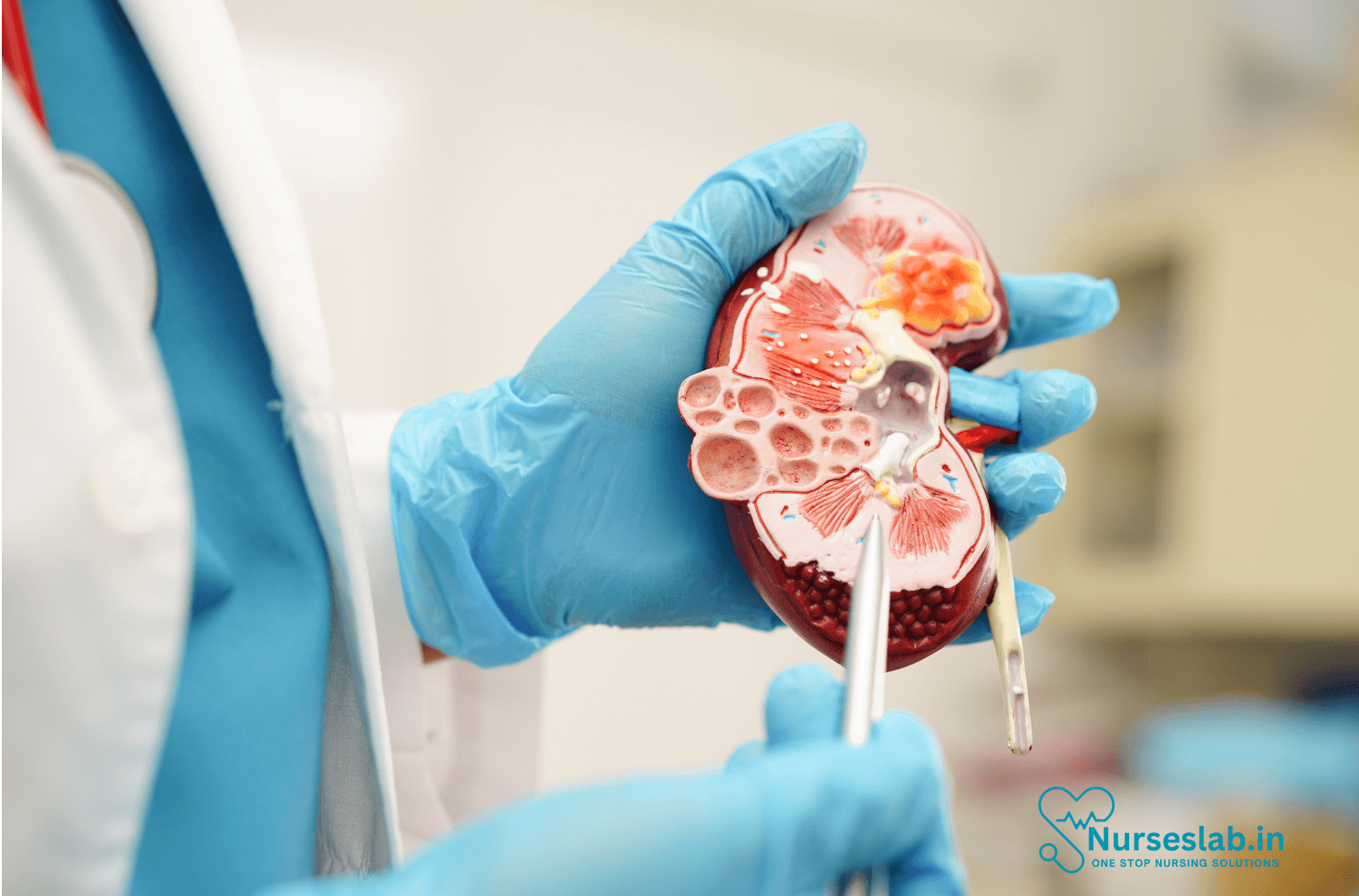 What GFR Reveals About Renal Function and Wellbeing - Nurseslab