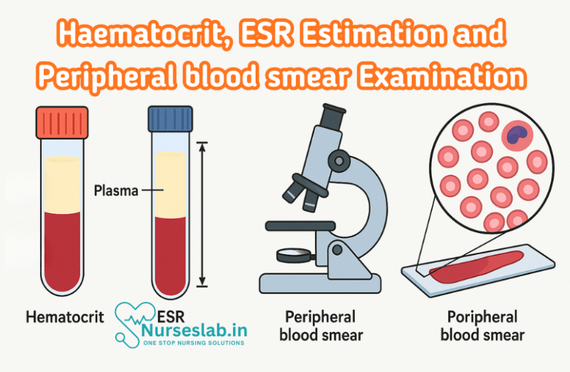 Pathology of Haematocrit, ESR Estimation and Peripheral blood smear ...