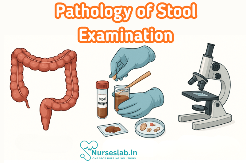Pathology of Stool Examination: A Comprehensive Guide - Nurseslab