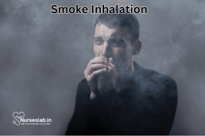 First Aid for smoke Inhalation - Nurseslab