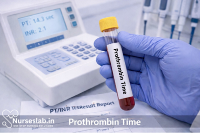 Prothrombin Time Test (PT/INR): A Comprehensive Guide - Nurseslab